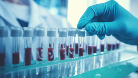 Infectious Disease External Quality Controls - Ensuring Accuracy