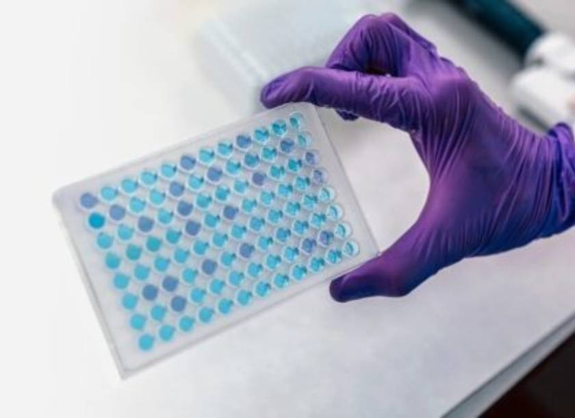 Microbix Biosystems: Comprehensive Infectious Disease Diagnostic Solutions